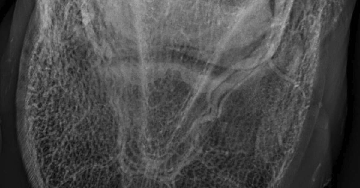 Case Study Uses Digital Venography To Identify Hard-To-Find Hoof ...