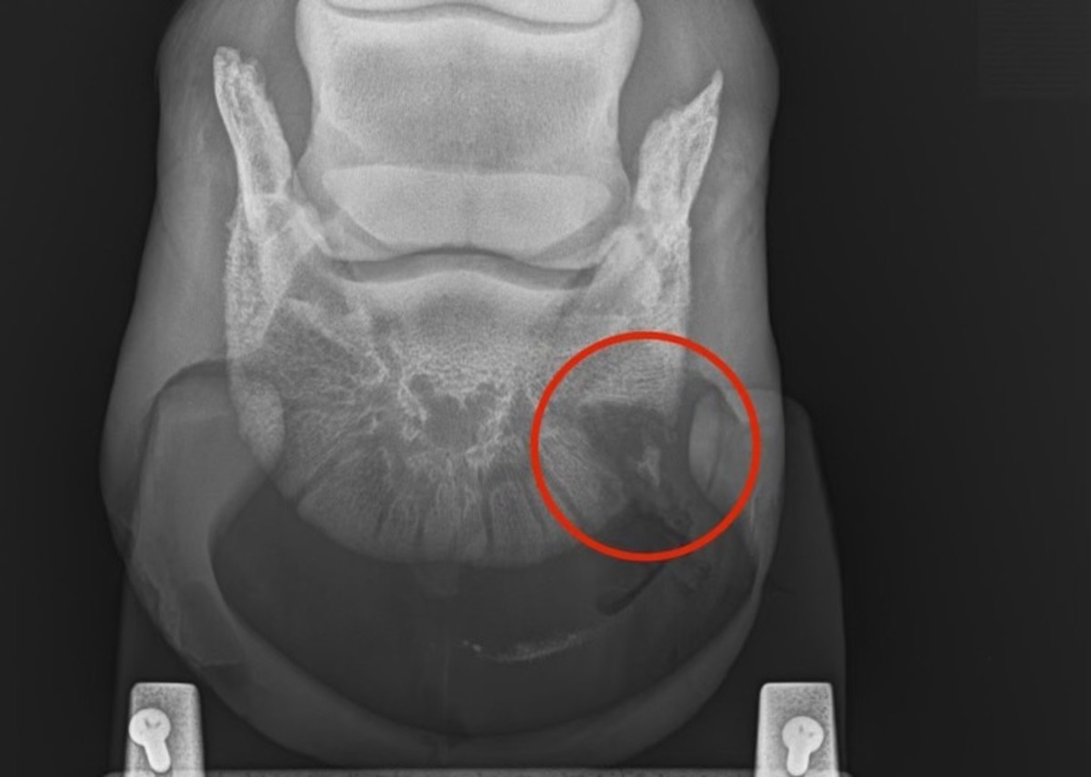 Rood & Riddle Podiatry: Recurrent Abscesses? It's Worth Taking A ...