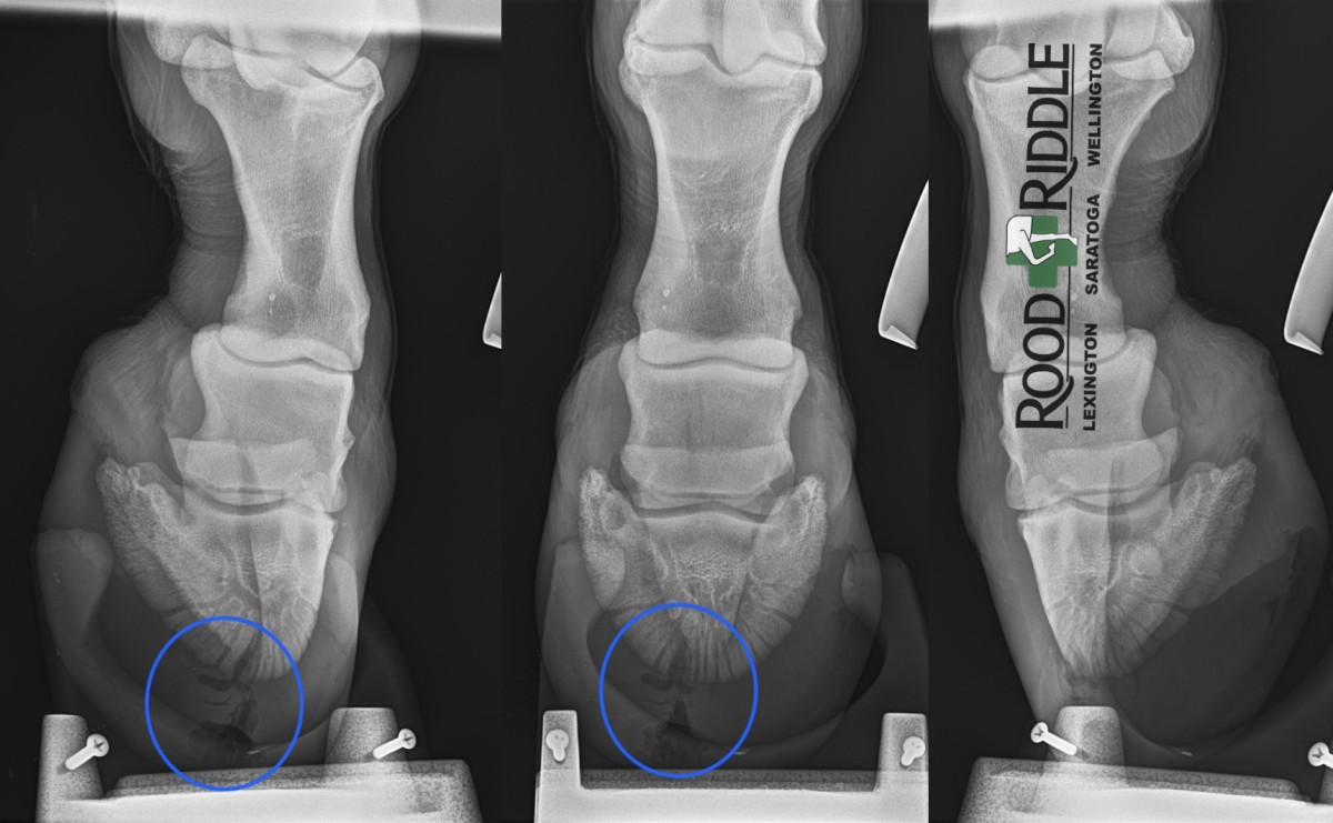 Rood & Riddle Podiatry: Larval Therapy Decreases Layup Time For Coffin ...