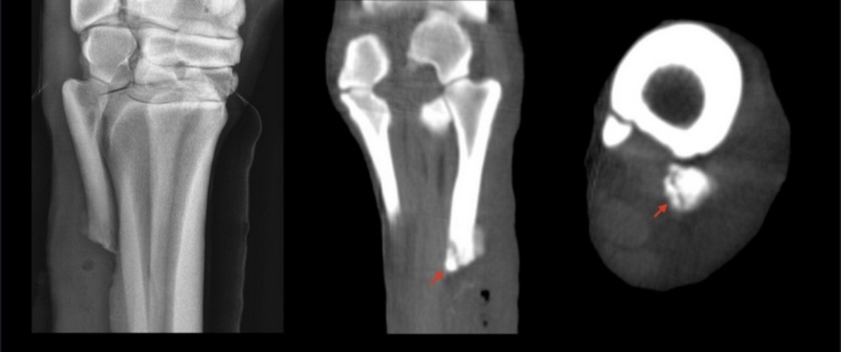 First Standing CT Scanner Installed At Texas' Equine Sports Medicine ...