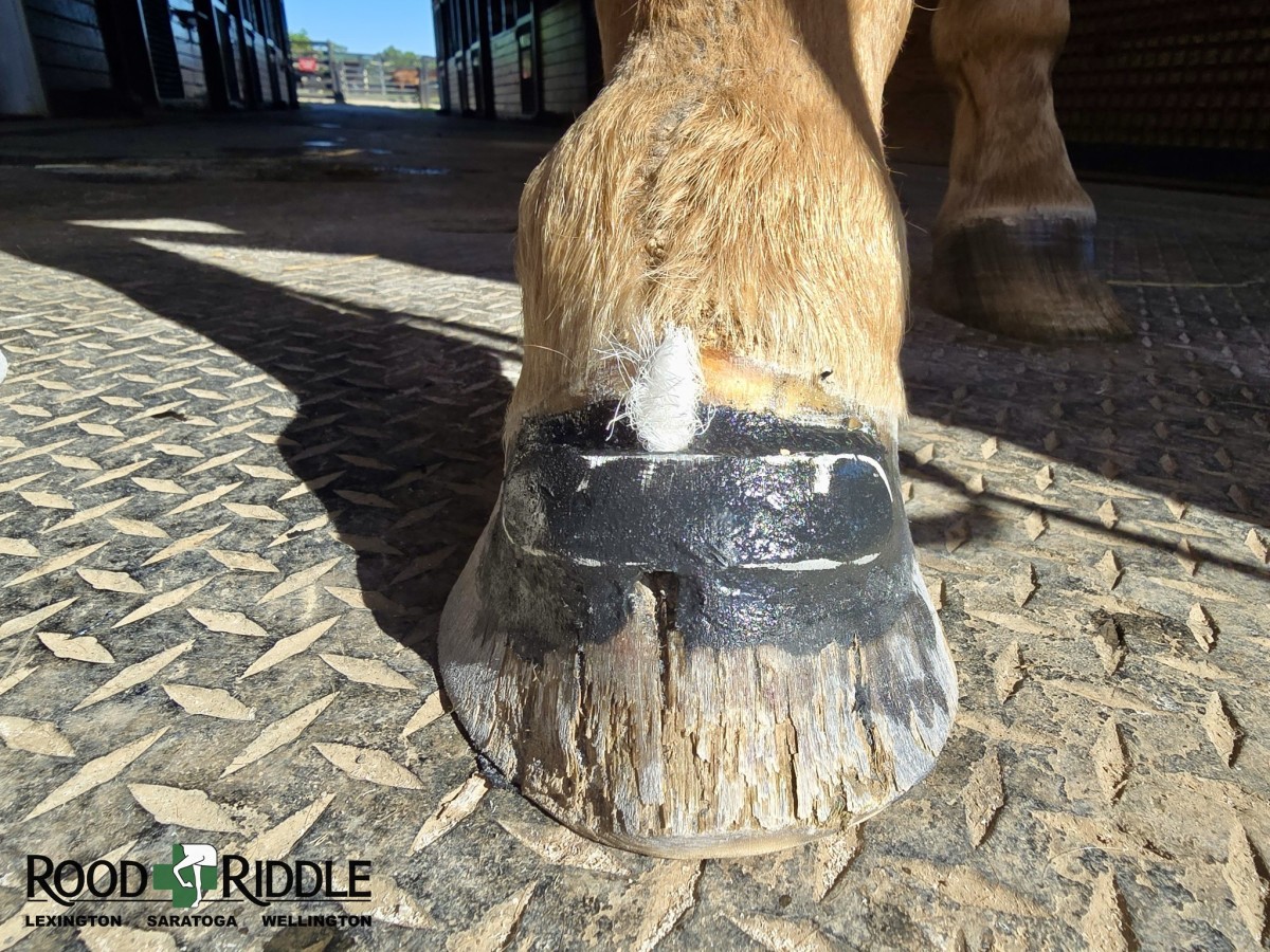 Rood & Riddle Podiatry: TLC Helps Arthrodesis Case Recover From Toe ...