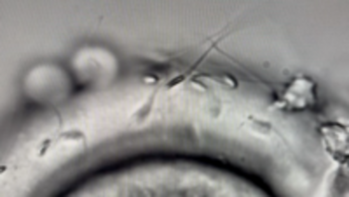 UC Davis First To Produce Equine Embryos Via In Vitro Fertilization ...