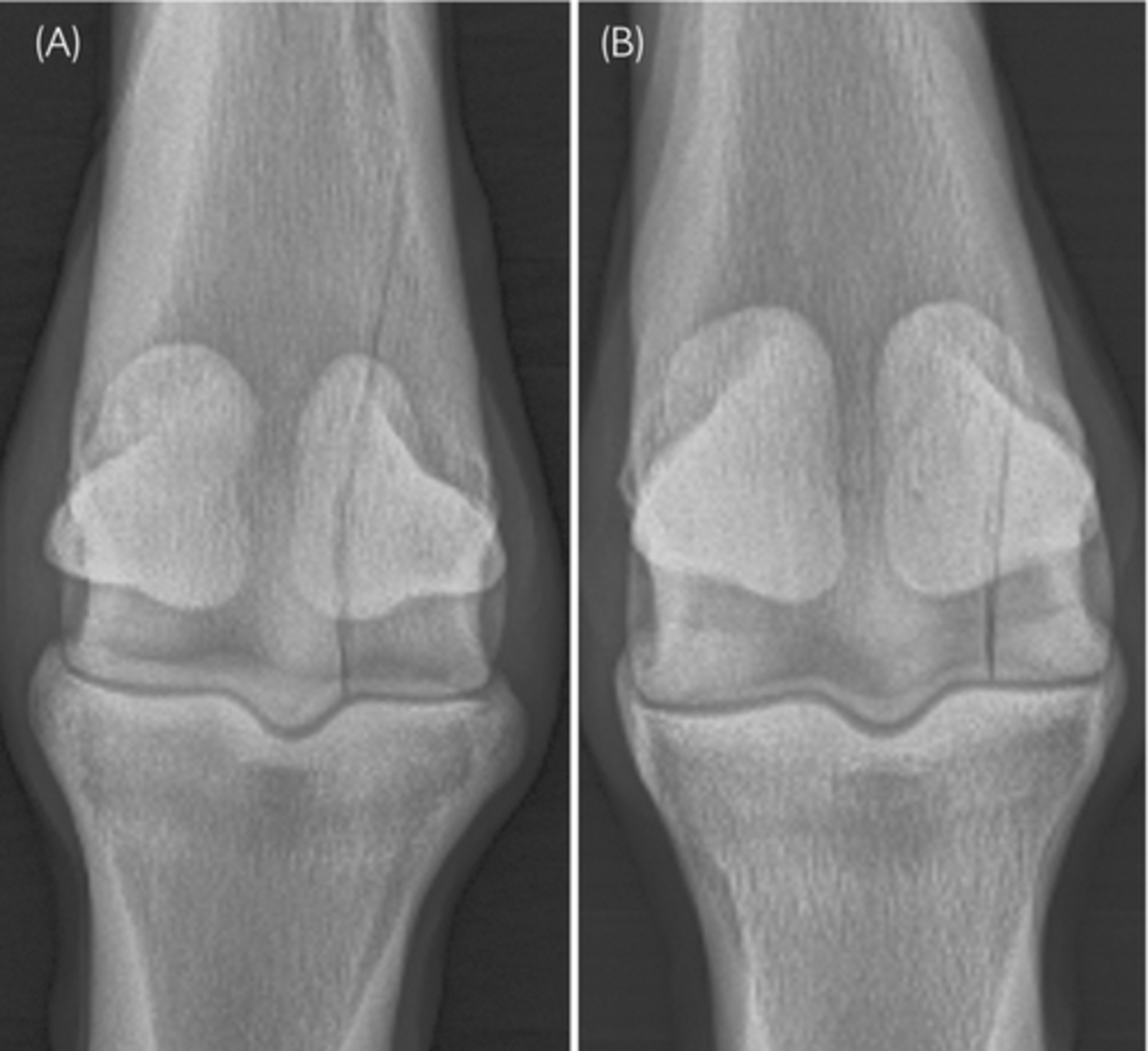 Study: Thoroughbred Exercise History Related To Condylar Fracture ...