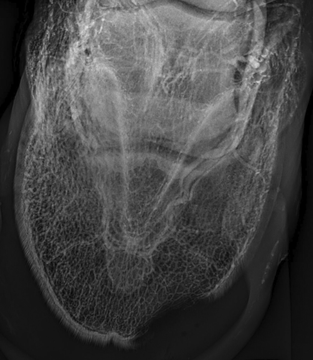 Case Study Uses Digital Venography To Identify Hard-To-Find Hoof ...