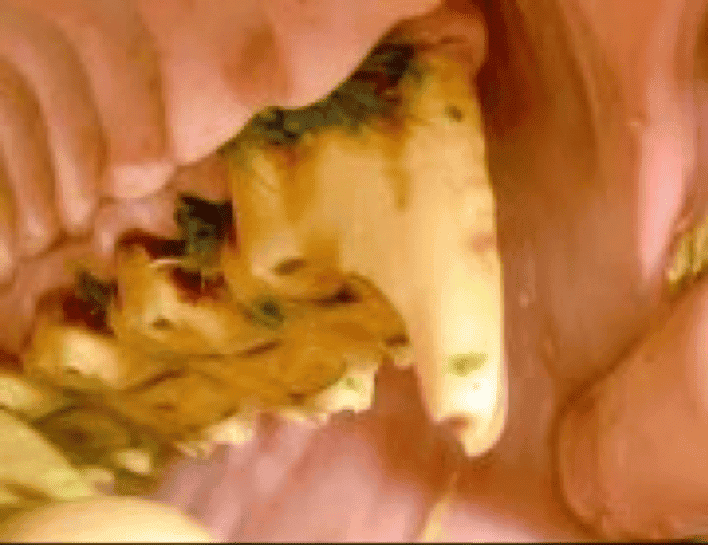 Early Detection, Routine Care Key To Maintaining Dental Health In ...